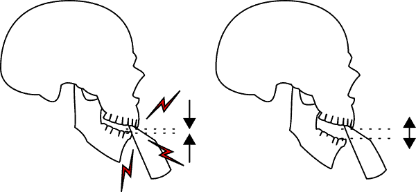 Stop teaching clarinet and saxophone embouchures like this | Bret ...